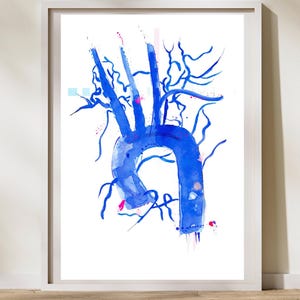 Aorta, Heart Surgery Cardiac Nurse Art Print Physician Assistant ...