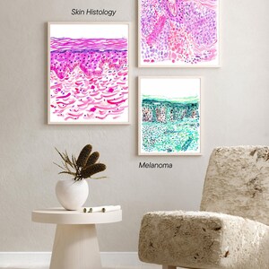 Skin Histology Art - Melanoma and Basal Cell Carcinoma Pathology ...