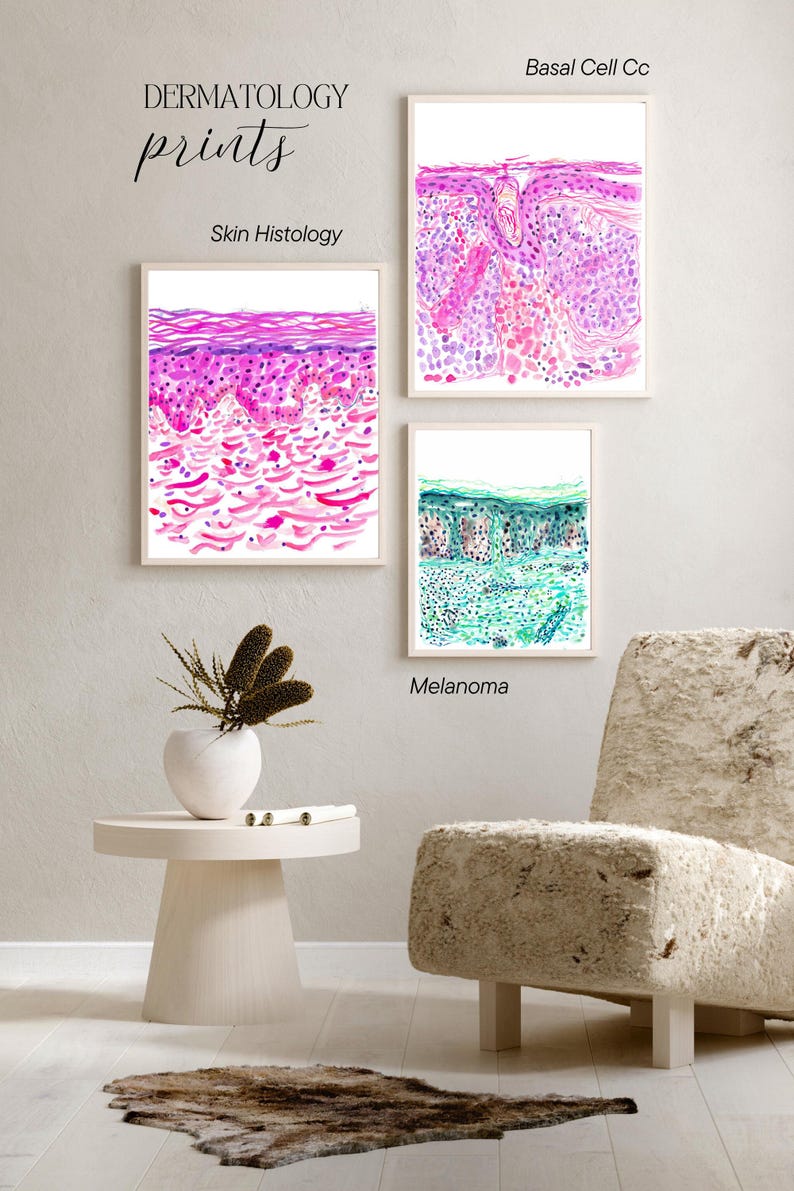 Skin Histology Art - Melanoma and Basal Cell Carcinoma Pathology ...