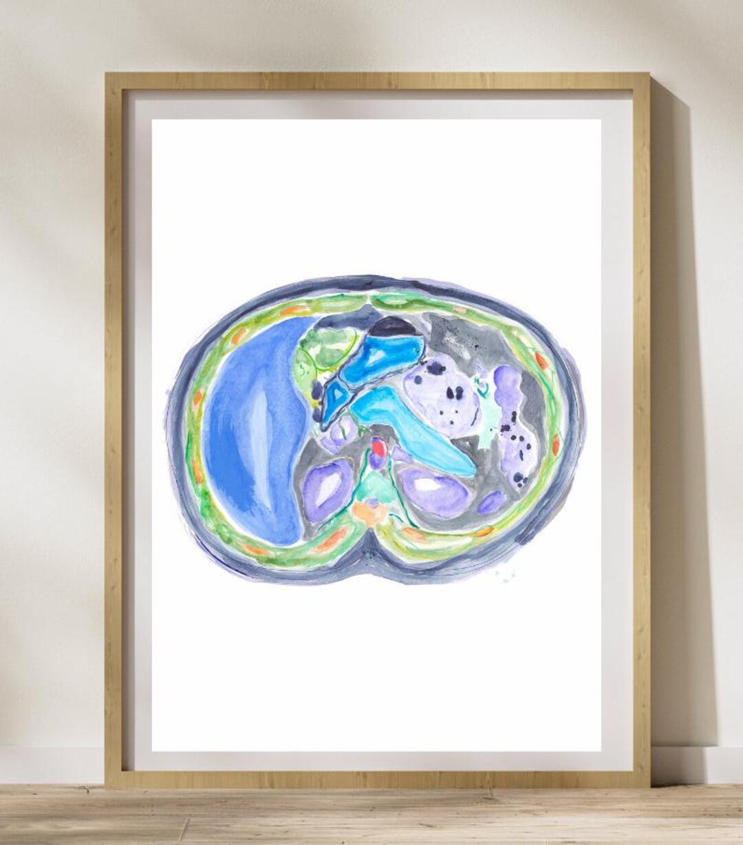 Radiology Artwork, CT Radiology, Abdominal Anatomy, Radiology Print ...