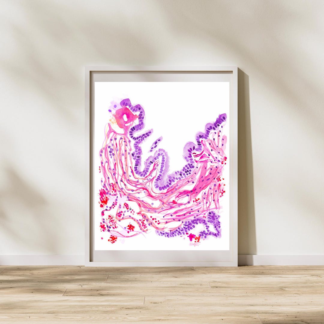 Lung Bronchiole Histology Art, Pathology Pulmonology Office Wall Decor ...