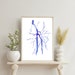 Femoral Artery Angiography, Vascular Surgeon Gift, Radiology Art ...