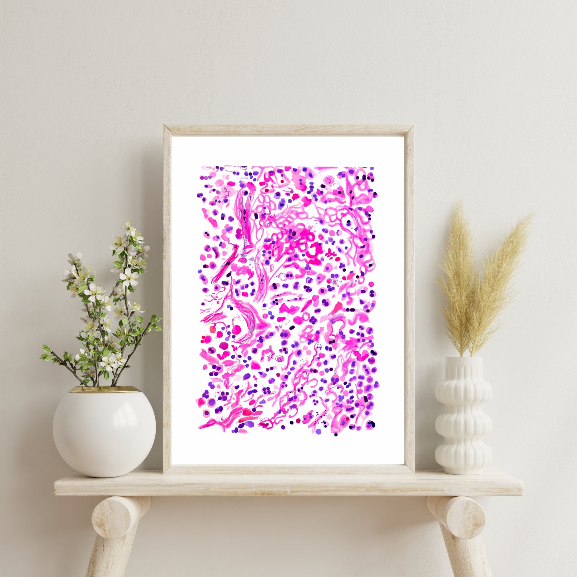 Pneumonia Pathology Art, Watercolor Lung Histology Print, Pulmonology ...