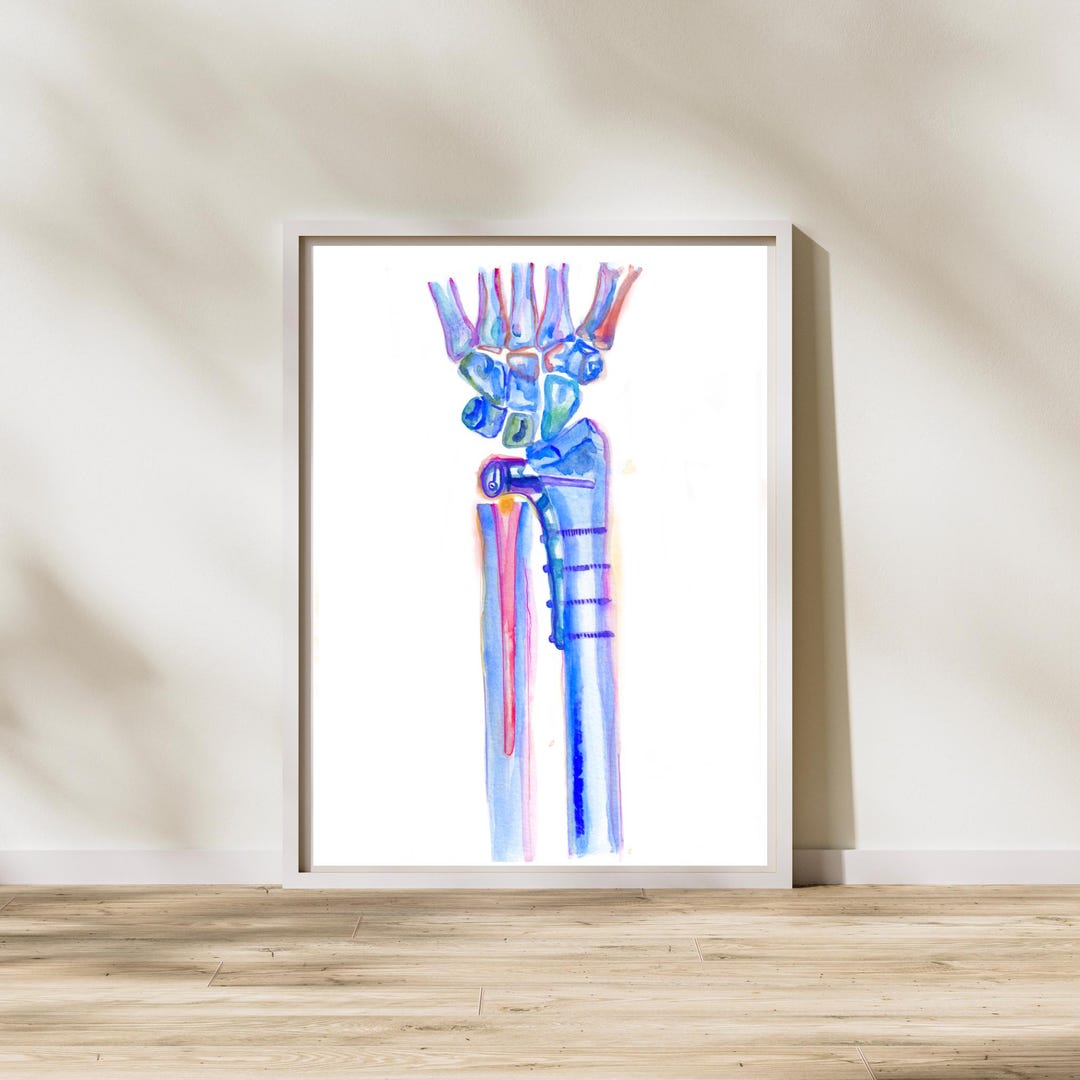Orthopedic Surgery Art, Joint Repair, Orthopedic Surgeon Gifts, Hand ...