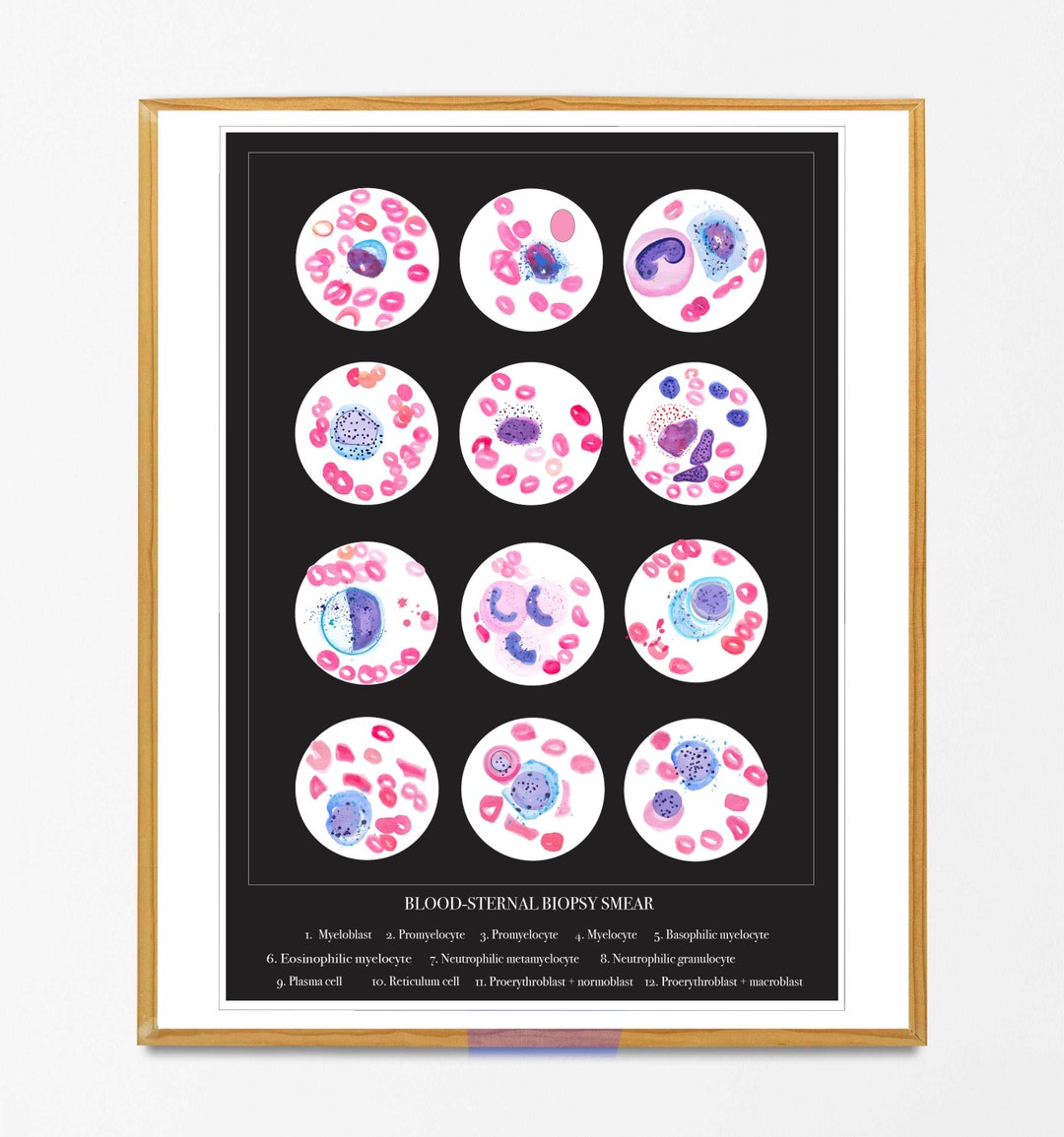 Blood Art, Blood Cells, Blood Smear, Laboratory Decor, Lab Tech Gift ...