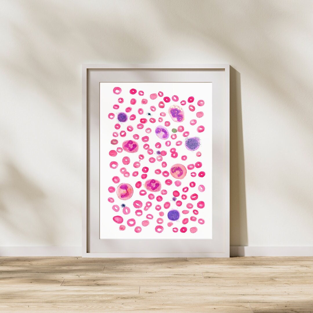 Blood Smear Watercolor Art Print for Hematology and Phlebotomy Office ...