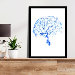 Brain Angiogram - Brain Angiography, Radiology Art, Neurology Art ...