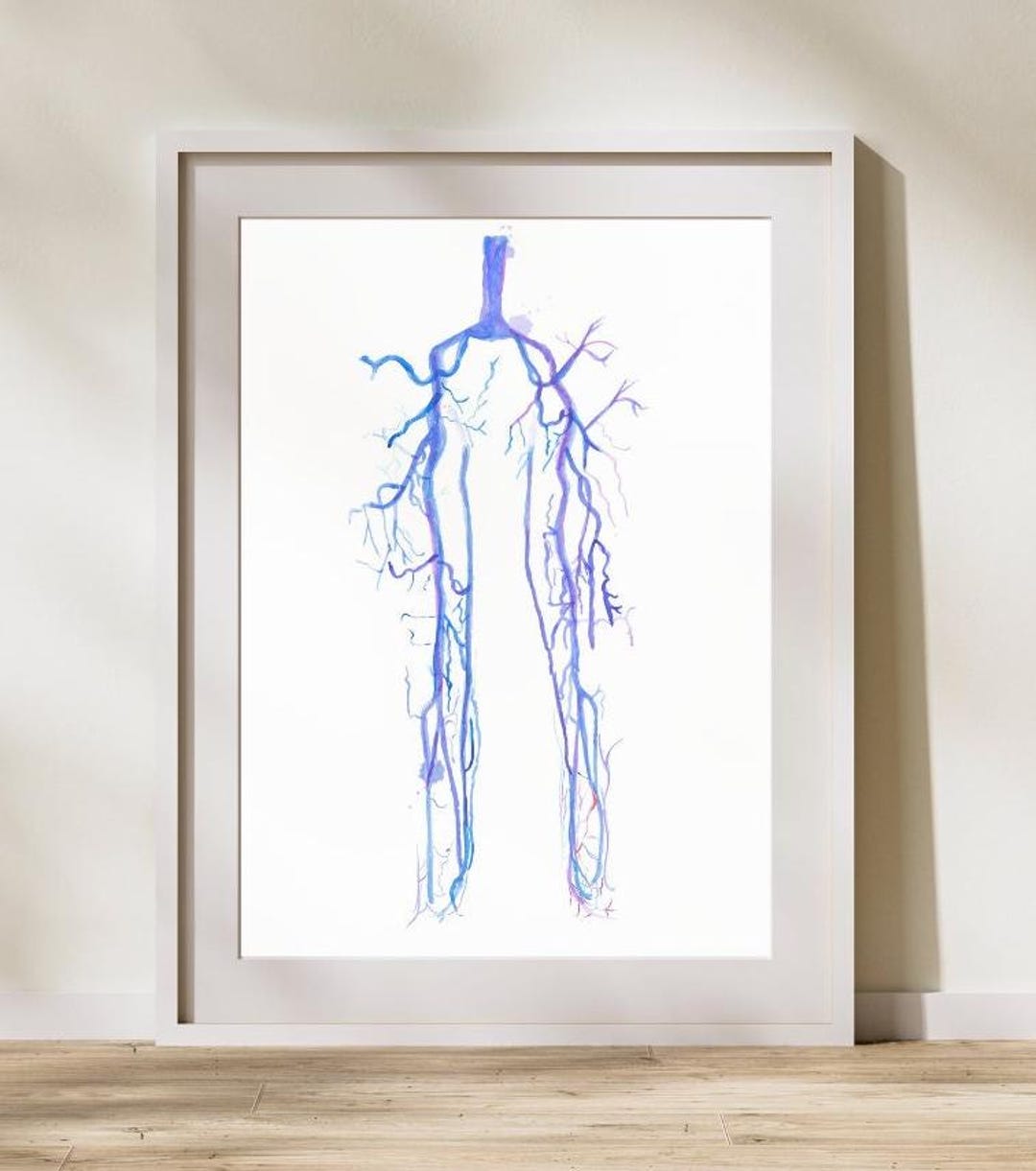 Lower Limb CTA, Radiology Art, Angio Tech, Vascular Surgery Fellowship ...