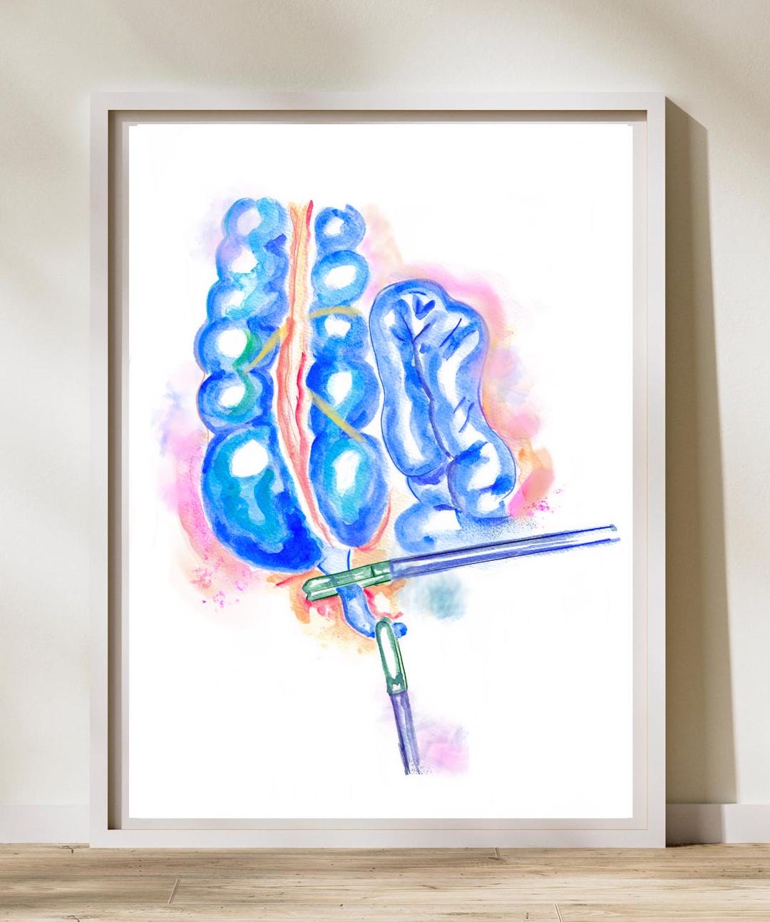 Appendectomy, Surgery Decor, General Surgeon Gift, Surgery Resident ...
