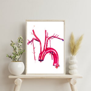 Aorta Anatomy, Aorta Art, Cardiology Art, Human Anatomy Art ...