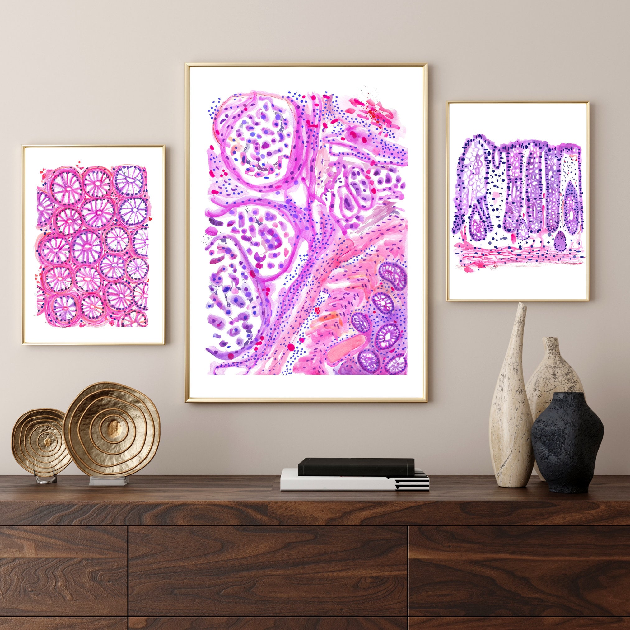 Colon Histology and Pathology Watercolor Art, Gastroenterology and ...