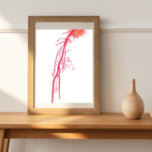 Arm Artery Anatomy Art, Upper Limb Arteries, Vascular Surgery Art ...