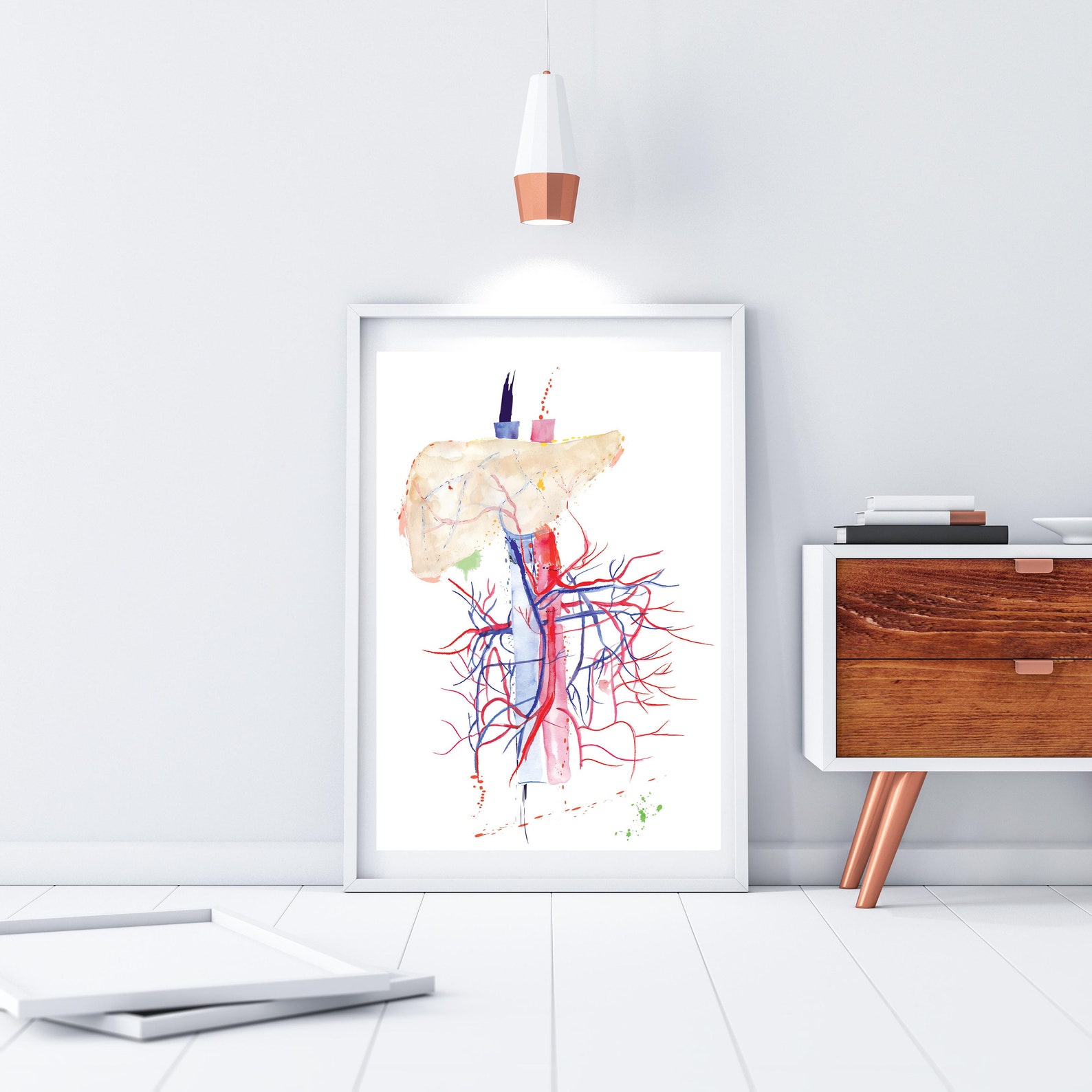 General Surgery Art Vascular Surgery Art Abdominal Arteries - Etsy