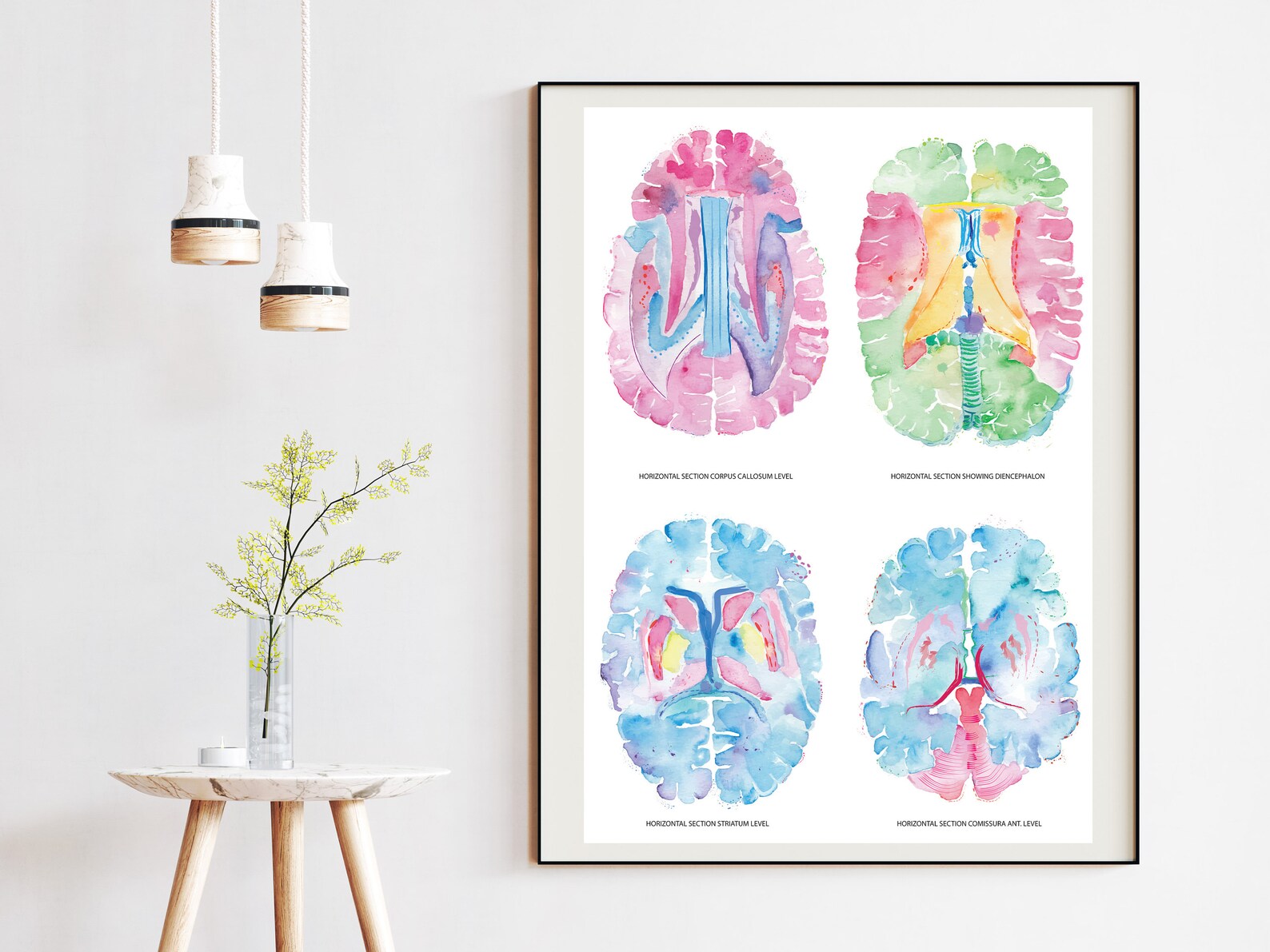 Brain Anatomy Art Neuroscience Art Neurology Art Neurology - Etsy