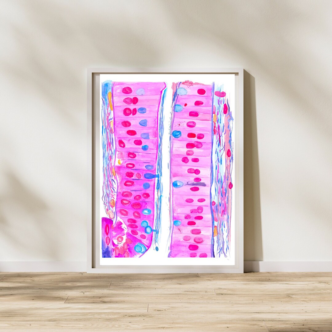 Duodenum Histology Art, Histology Artwork, Pathology Art, Endoscopy ...