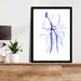 Femoral Artery Angiography, Vascular Surgeon Gift, Radiology Art ...