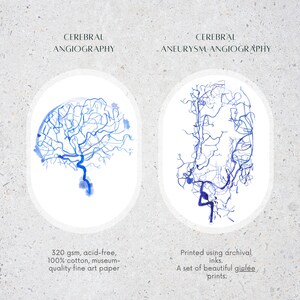 Cerebral Angiography, Cerebral Aneurysm, Set of 2, Brain Anatomy ...