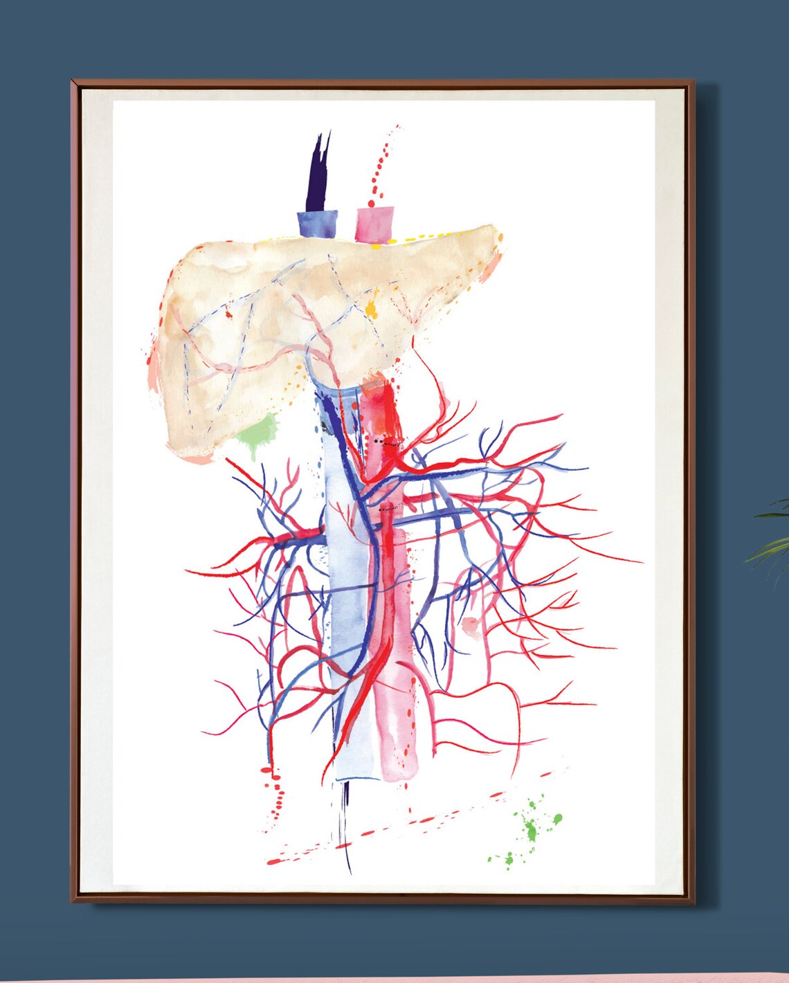 General Surgery Art Vascular Surgery Art Abdominal Arteries - Etsy