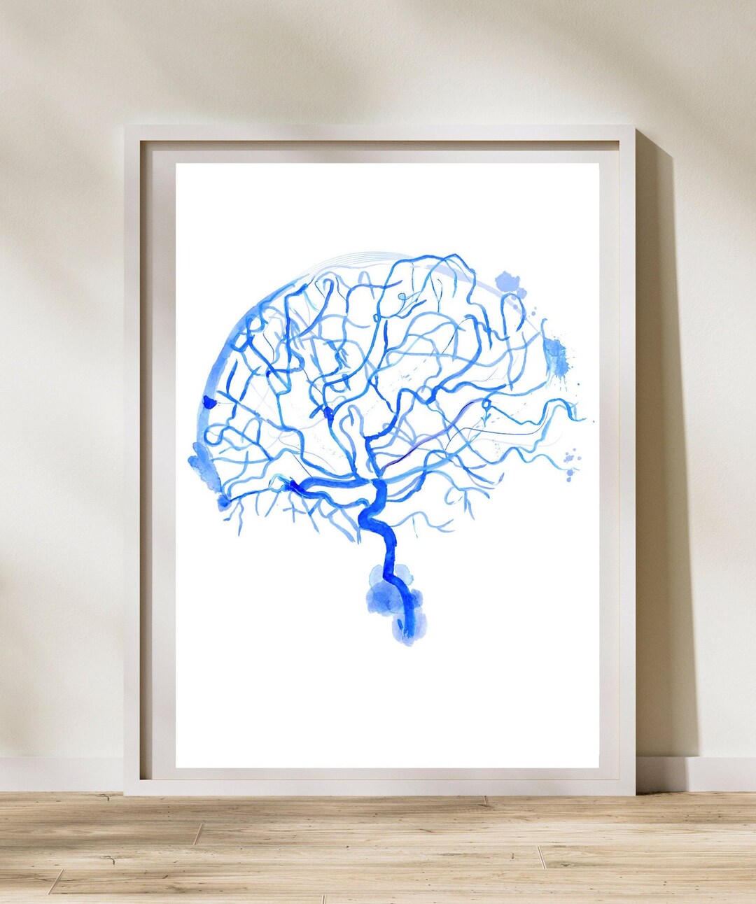 Cerebral Angiography, Brain Anatomy, Radiology Art, Rad Tech Gift ...
