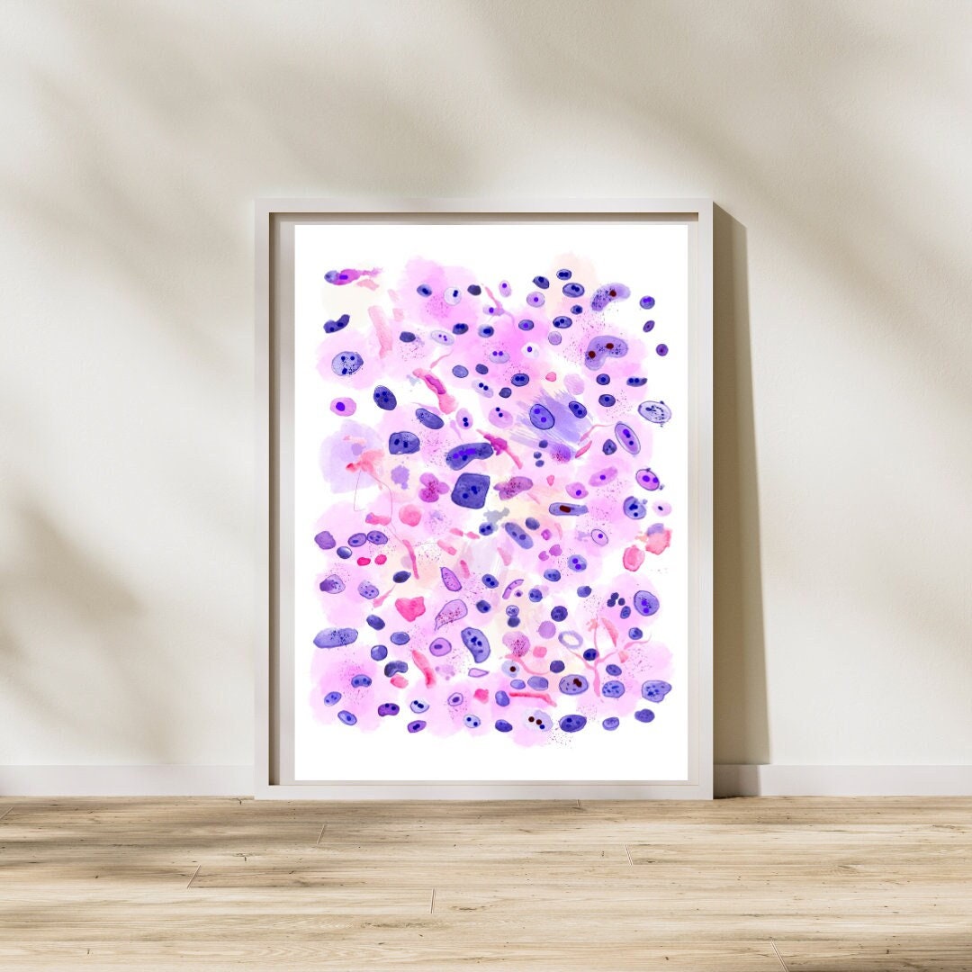 Hodgkin Lymphoma Pathology Art, Oncology Art, Pathology Artwork ...