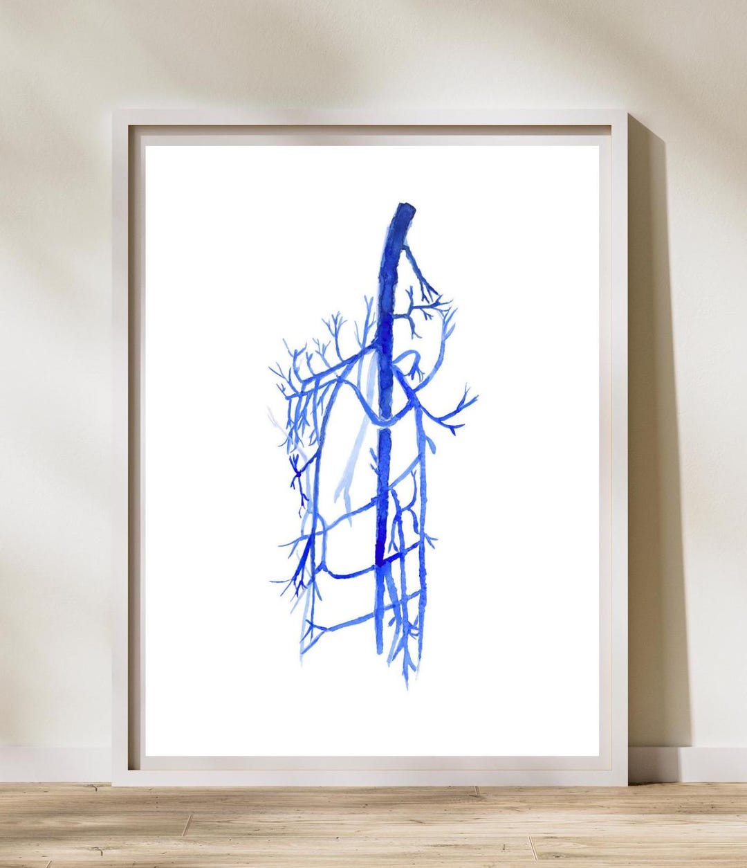 Popliteal Tibial Angiography, Lower Limb DSA, Radiology Art, Vascular ...