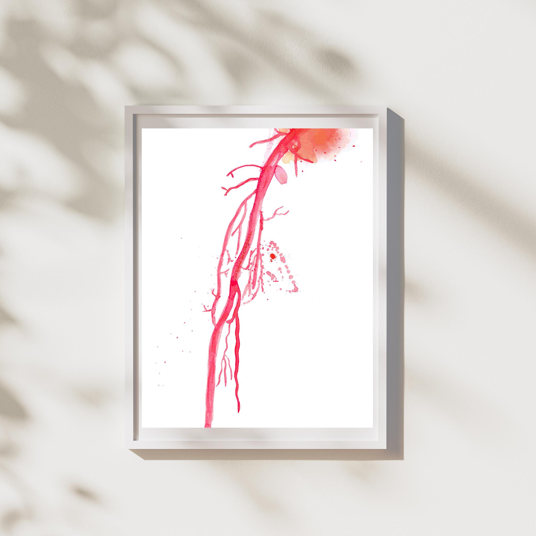 Arm Artery Anatomy Art, Upper Limb Arteries, Vascular Surgery Art ...