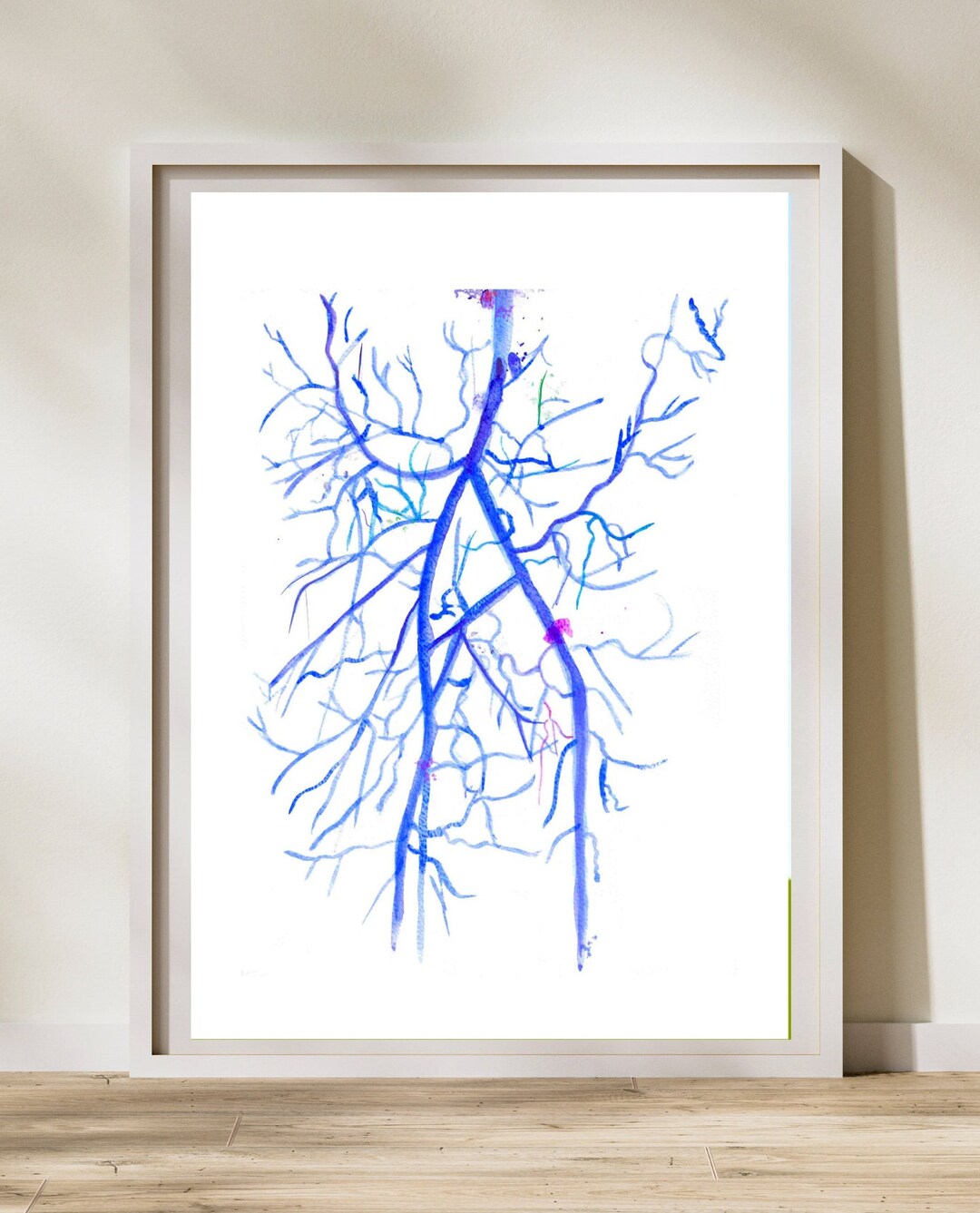 Arm Angiogram, Arm Vascular Anatomy, Vascular Surgery Art, Vascular ...
