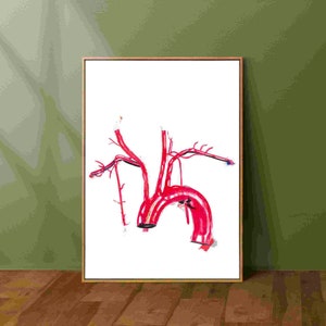Aorta Anatomy, Aorta Art, Cardiology Art, Human Anatomy Art ...