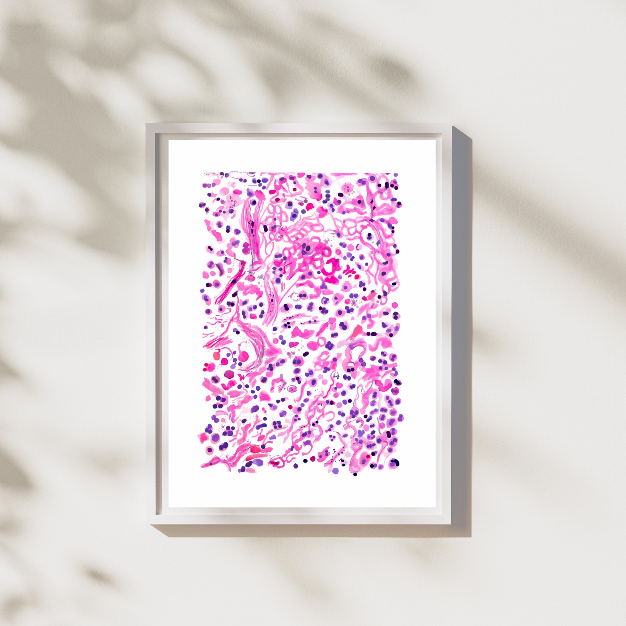 Pneumonia Pathology Art, Watercolor Lung Histology Print, Pulmonology ...