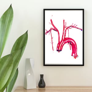 Aorta Anatomy, Aorta Art, Cardiology Art, Human Anatomy Art ...