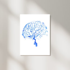 Brain Angiogram - Brain Angiography, Radiology Art, Neurology Art ...