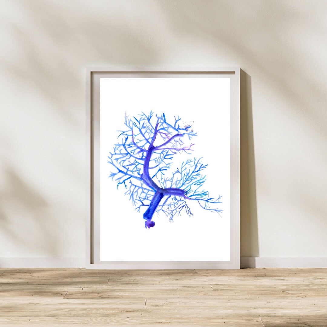 Portal Venogram Radiology Art, Gastroenterology Art, General Surgery ...