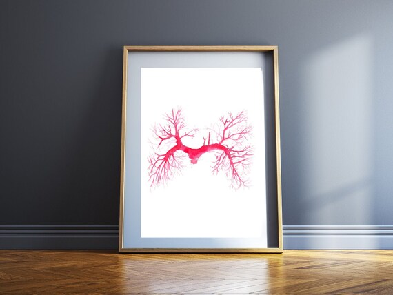 Pulmonary Embolism Angiography CT Angio Radiology Art Print | Etsy