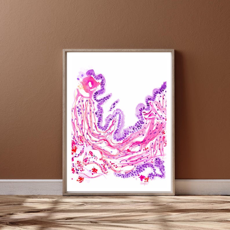 Lung Bronchiole Histology Art, Pathology Pulmonology Office Wall Decor ...