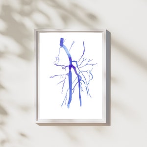 Femoral Artery Angiography, Vascular Surgeon Gift, Radiology Art ...