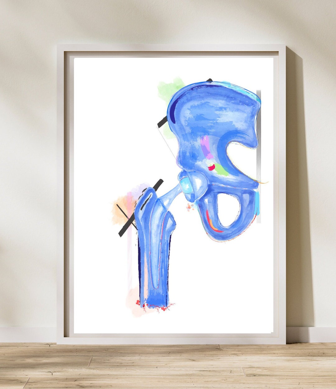 Hip Replacement, Orthopedic Surgery Art, Physical Therapy Art ...