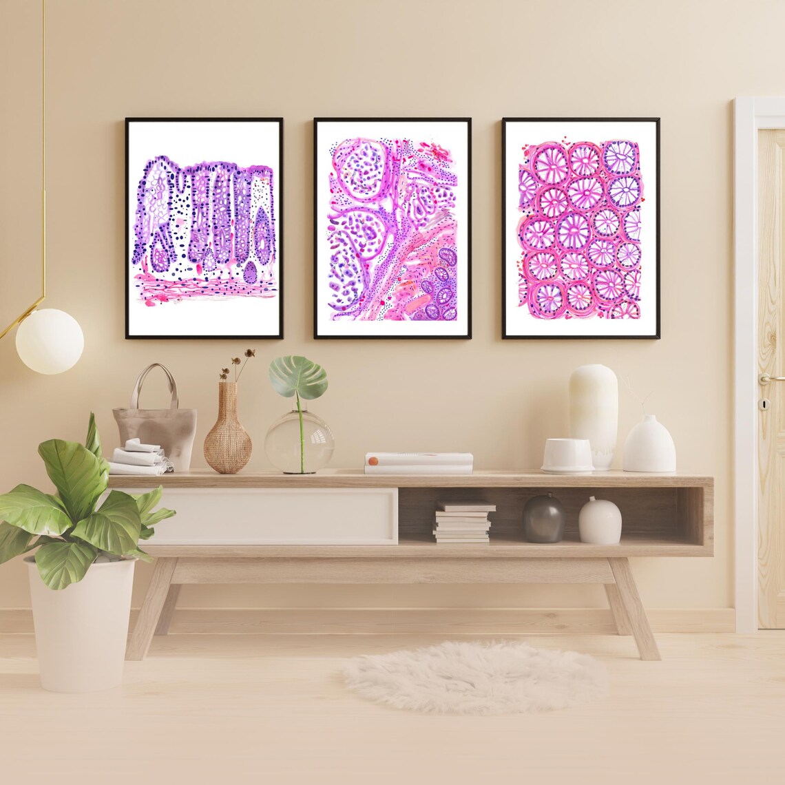 Colon Histology and Pathology Watercolor Art, Gastroenterology and ...