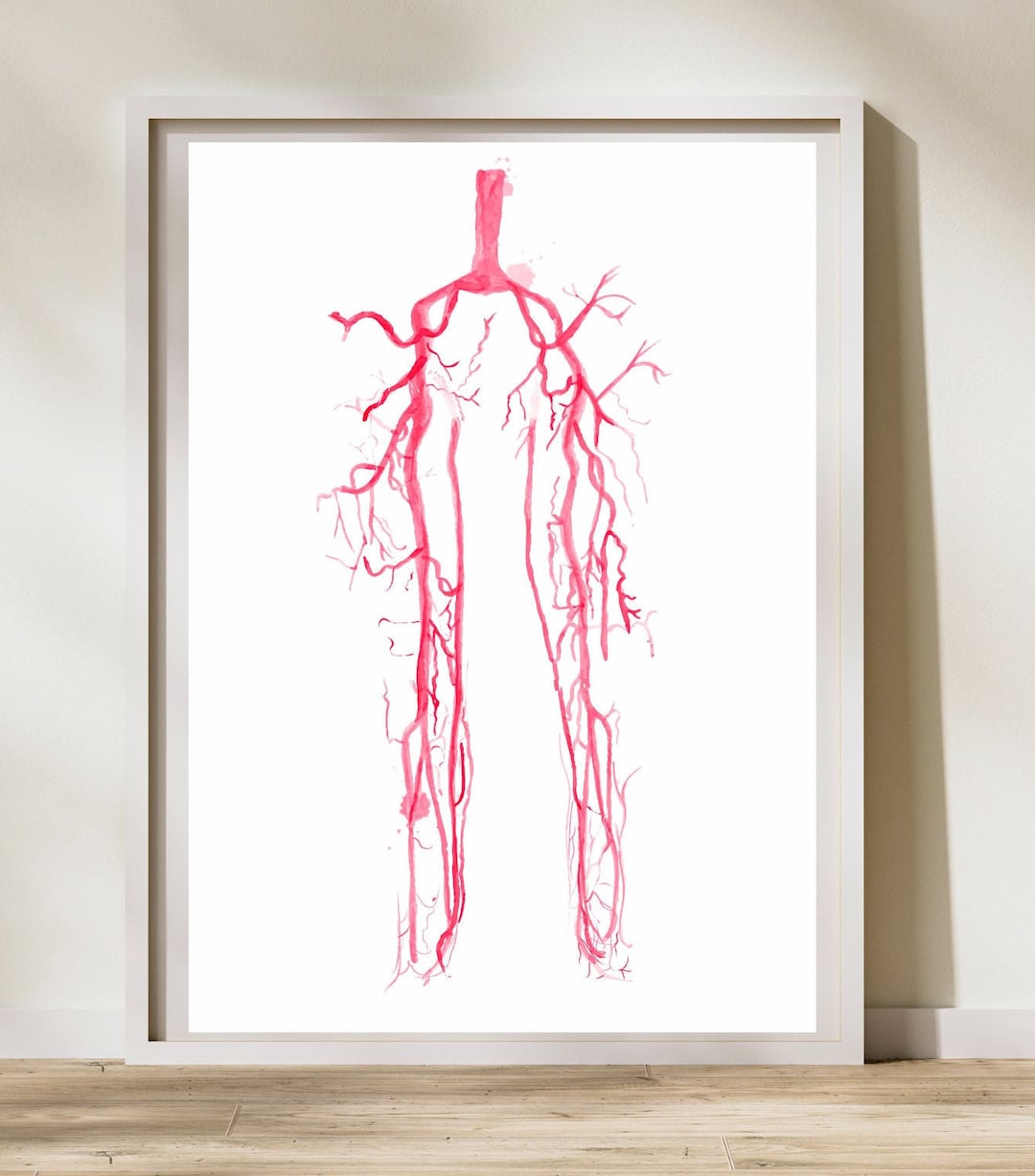 Lower Limb CTA, Angiography Watercolor Art, Radiology Art, Vascular ...