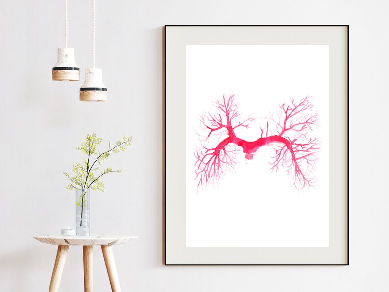 Pulmonary Embolism Angiography CT Angio Radiology Art Print | Etsy