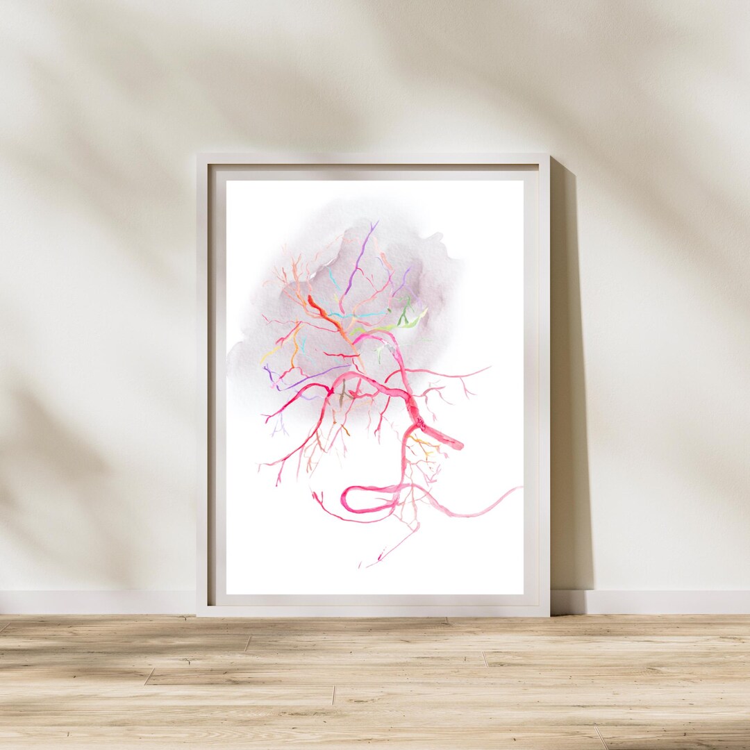 Hepatic Artery Anatomy Angiogram Radiology Art Gift for Radiologist ...