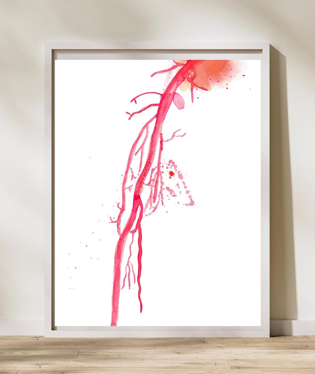 Arm Artery Anatomy Art, Upper Limb Arteries, Vascular Surgery Art ...