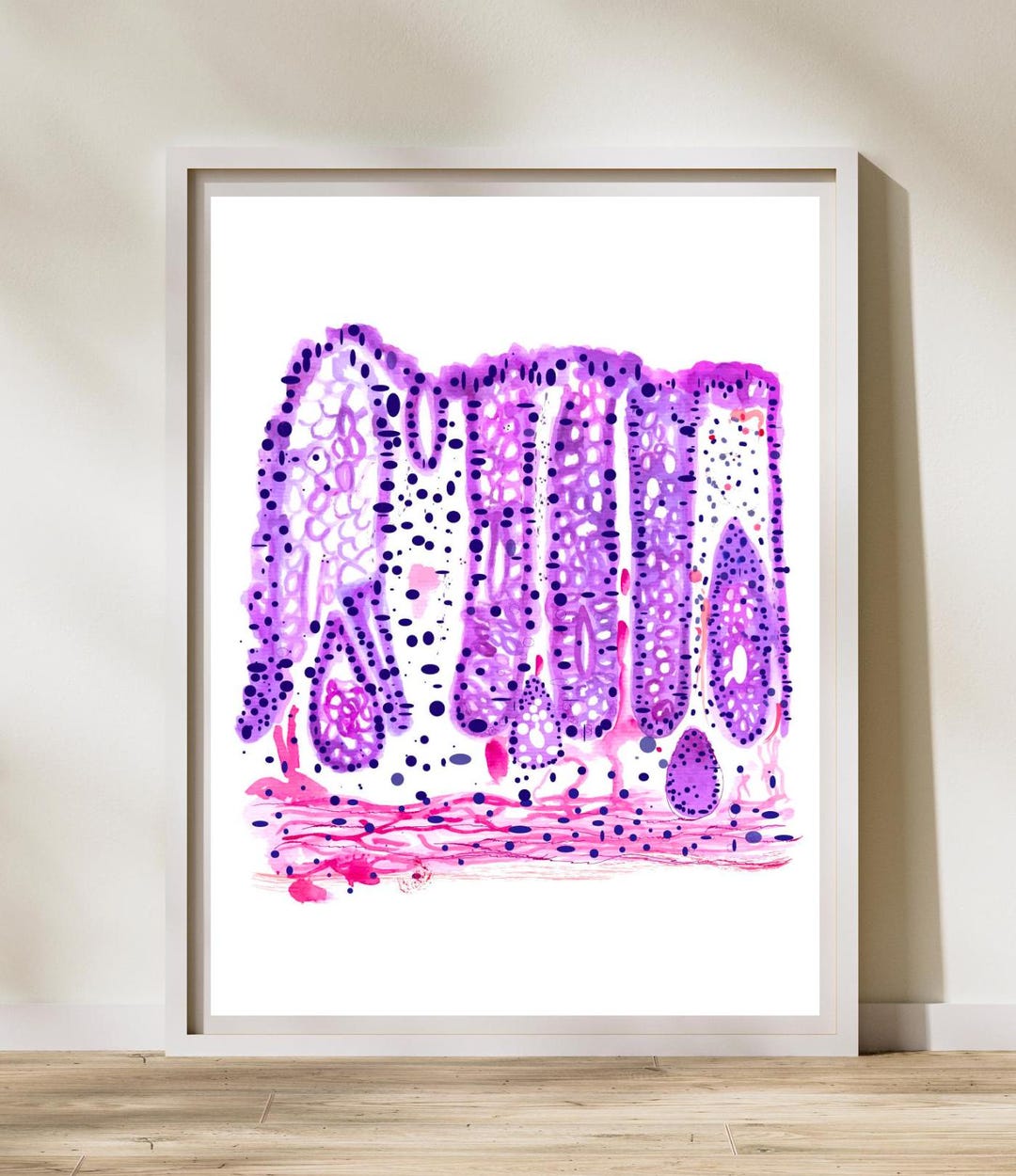 Colon Histology Art, Pathology Artwork, Endoscopy Biopsy Art ...