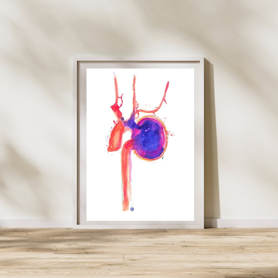 Aorta Art Aneurysm, Aorta Painting, Vascular Surgery Sonographer ...