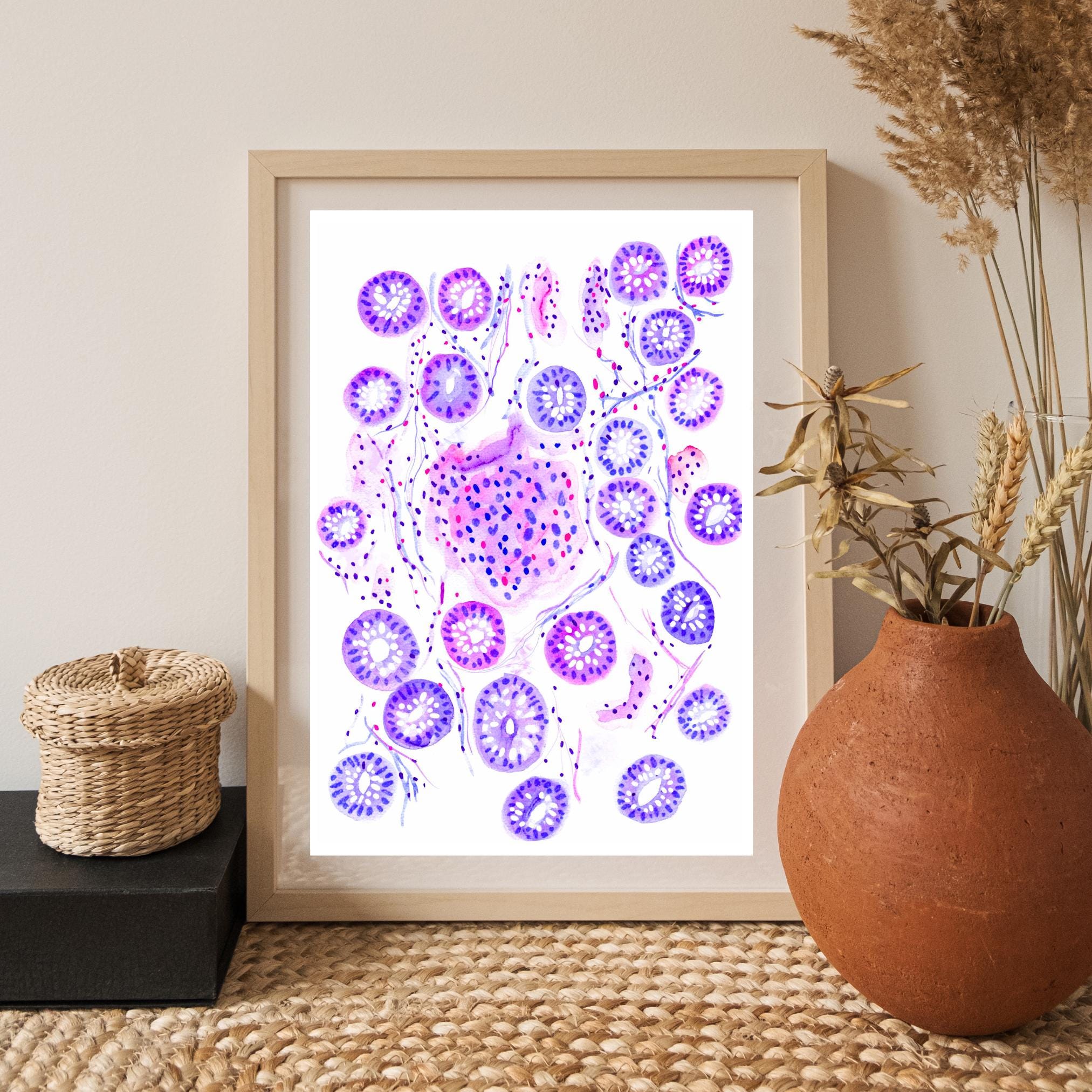 Crohn's Disease, Pathology Art, Histology Artwork, Pathologist Gift ...
