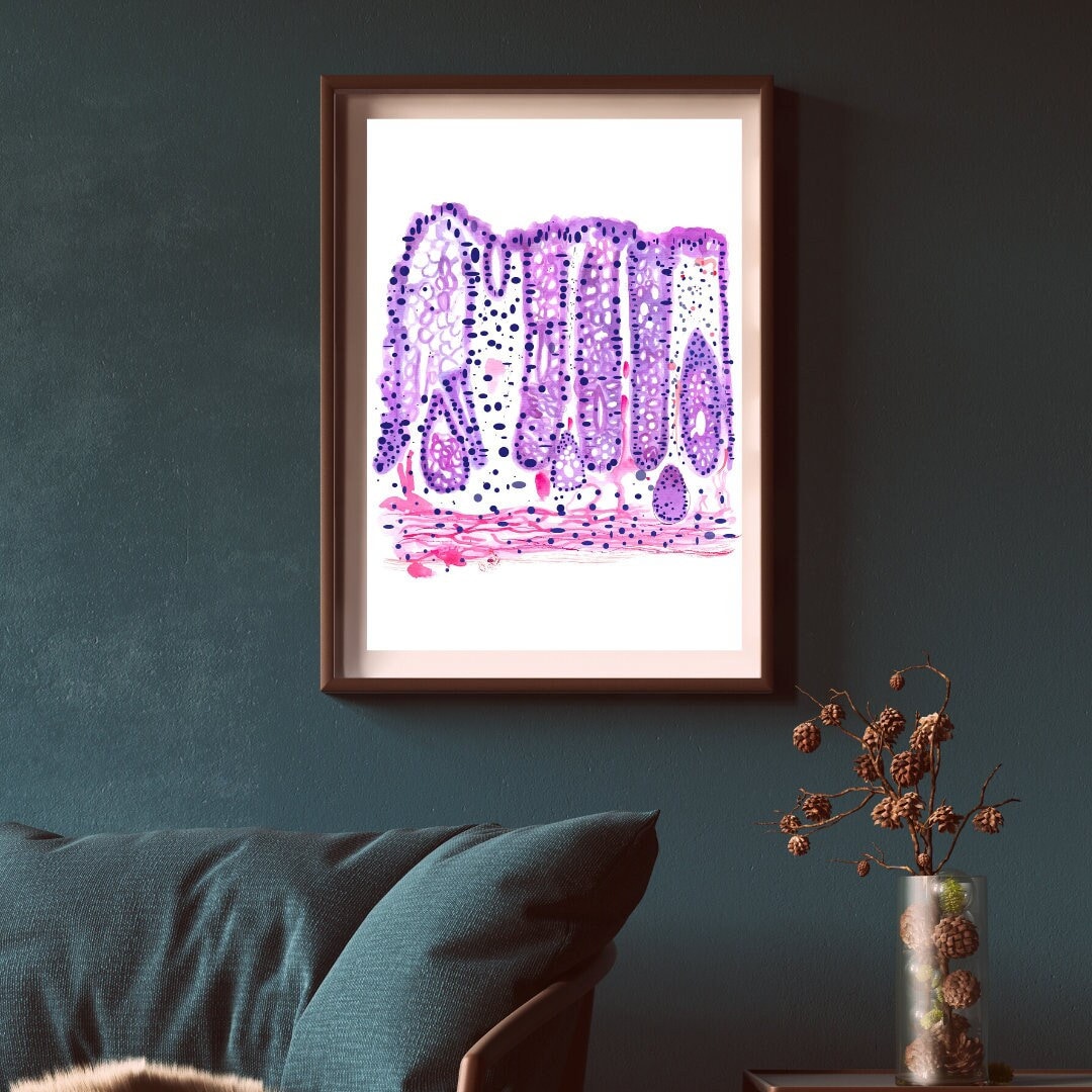Colon Histology Histology Art Pathology Art Pathology - Etsy