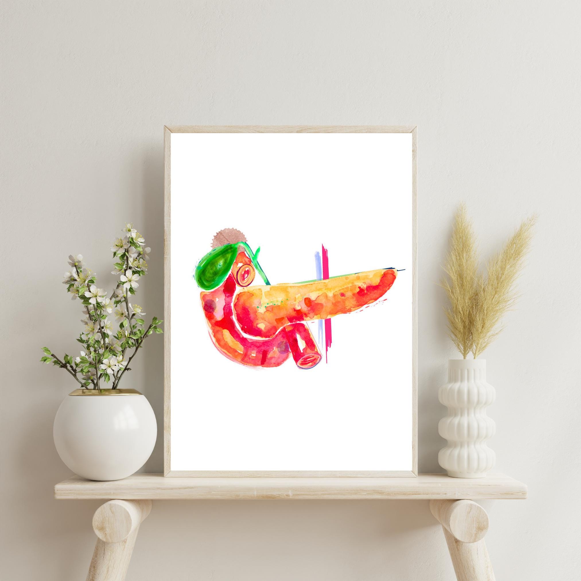 Pancreas Art, Gastrointestinal Art, GI Art, General Surgery Art ...