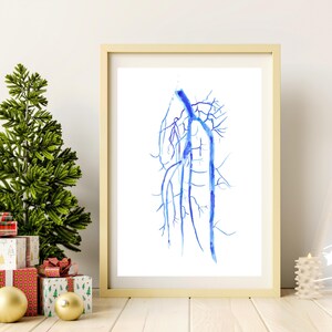 Popliteal Tibial Angiography, Lower Limb DSA, Radiology Art, Vascular ...