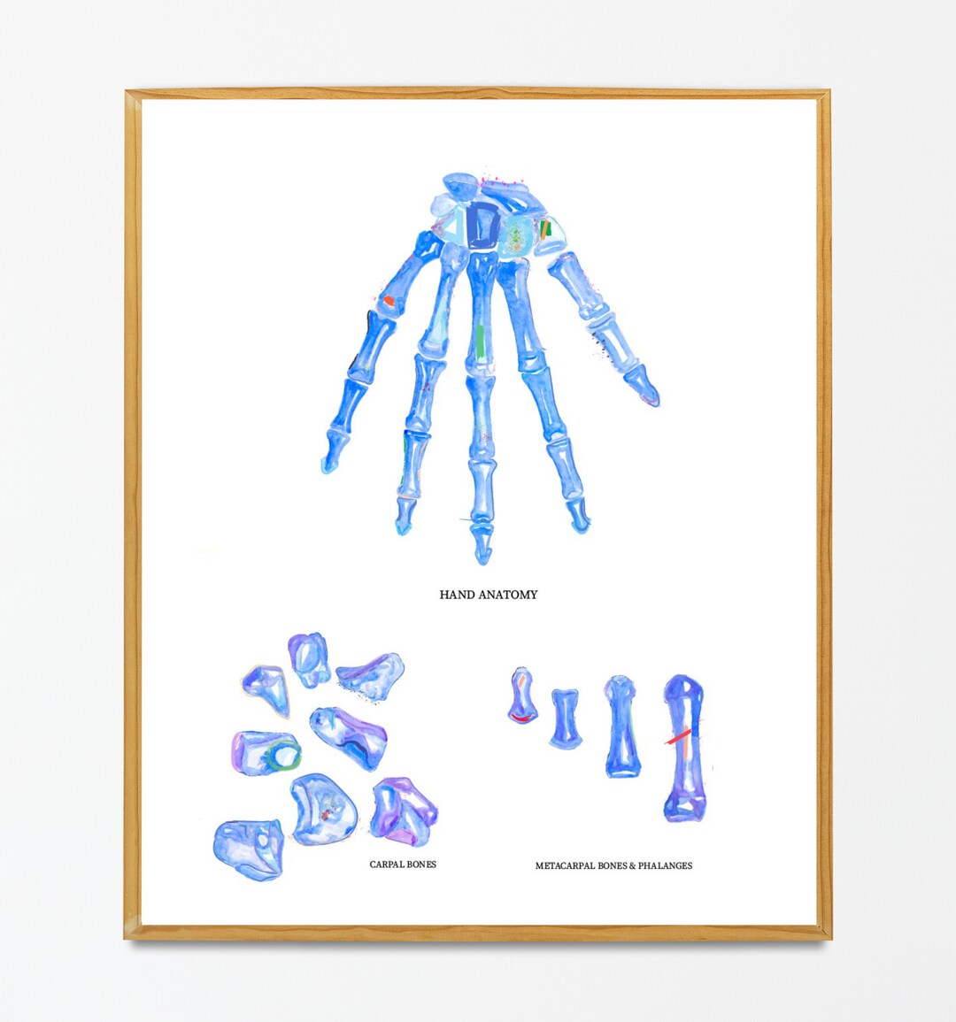 Hand Anatomy, Orthopedic Art, Physical Therapy Art, Hand Surgery, Hand ...
