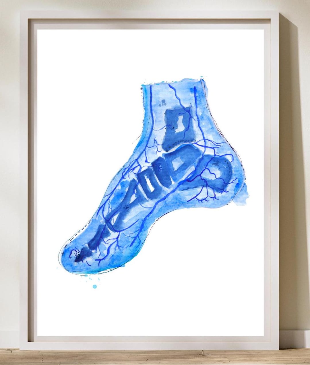 Foot Radiology, Podiatry Decor, Vascular Surgery Art, Foot CTA ...