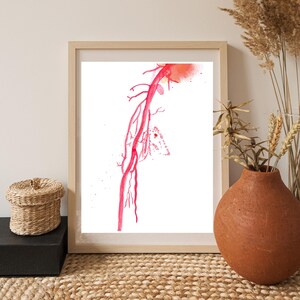 Arm Artery Anatomy Art, Upper Limb Arteries, Vascular Surgery Art ...